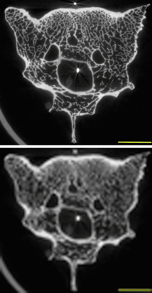 [PDF] CT artifacts: Causes and reduction techniques | Semantic Scholar